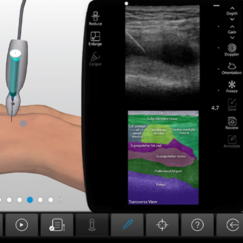 Knee Joint Injection & Aspiration Procedure | SonoSim