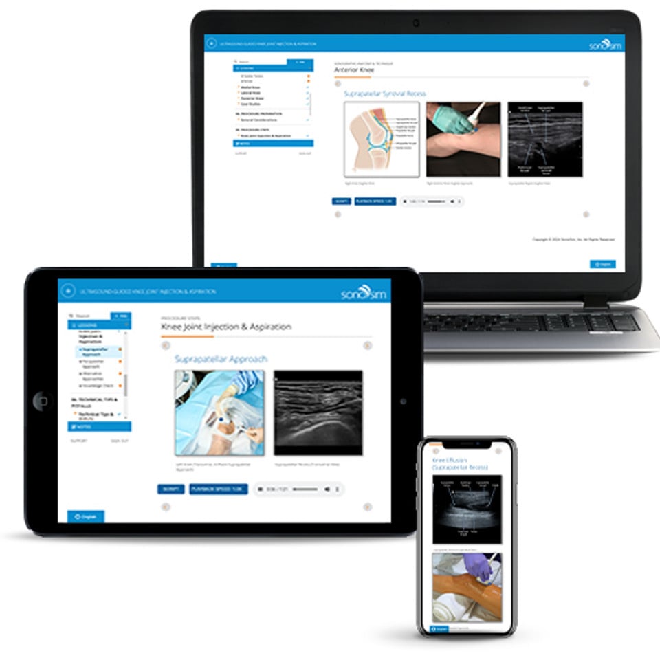 Knee Joint Injection & Aspiration Procedure | SonoSim