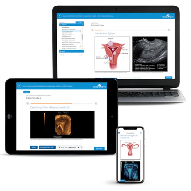 GYN Ultrasound of Nonpregnant Abnormal Uterus Advanced Clinical ...
