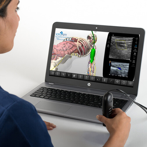 Vascular Mapping for Preoperative Planning of Dialysis Access Advanced ...