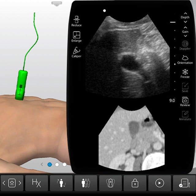 Biliary Tree Anatomy & Physiology Ultrasound Training | SonoSim