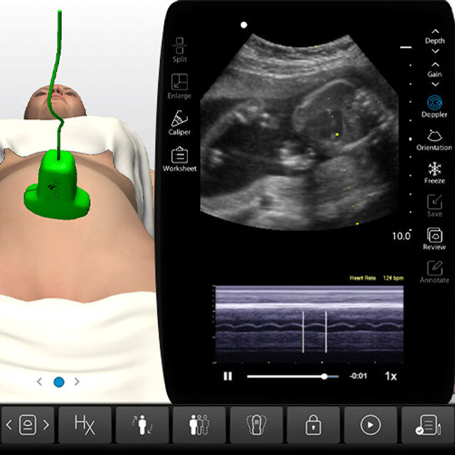 Obstetrics Clinical Ultrasound Training | SonoSim