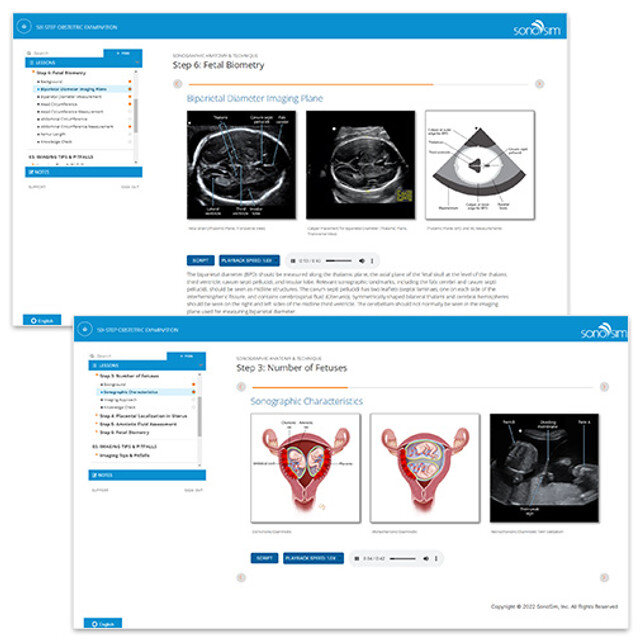 Obstetrics Clinical Ultrasound Training | SonoSim