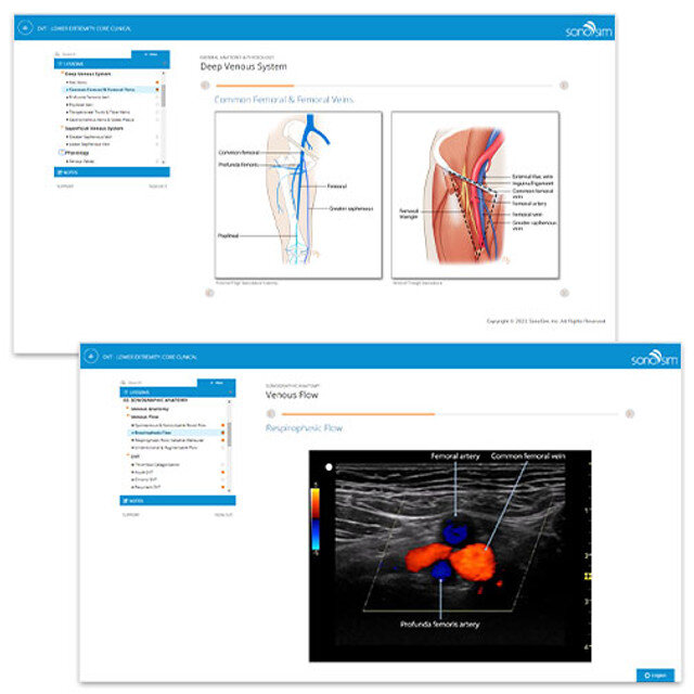 DVT Clinical Ultrasound Training | SonoSim