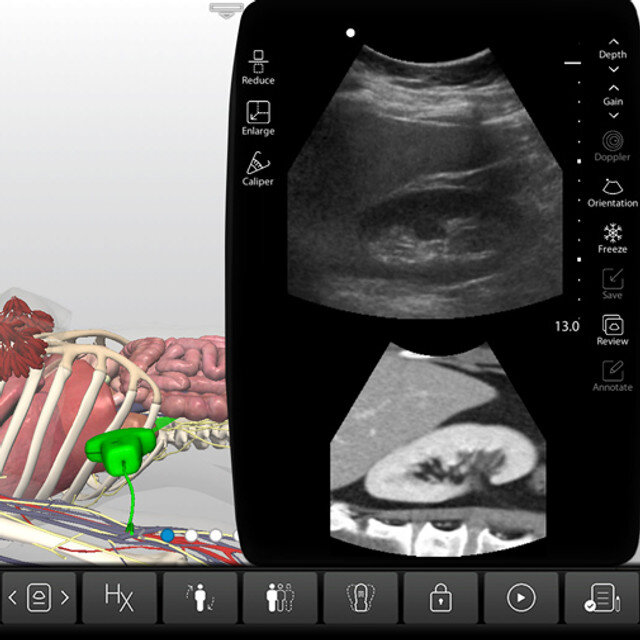 eFAST Clinical Ultrasound Training | SonoSim