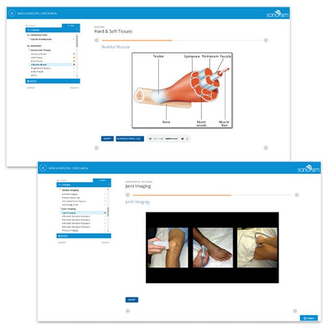 MSK Clinical Ultrasound Training | SonoSim