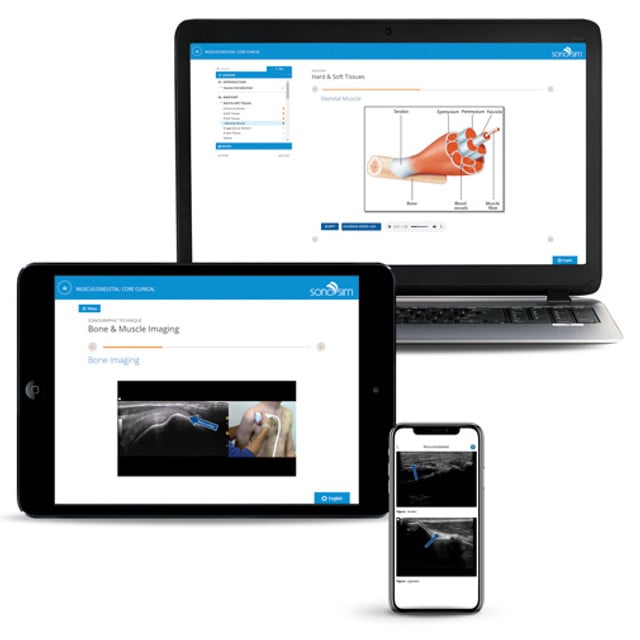 MSK Clinical Ultrasound Training | SonoSim