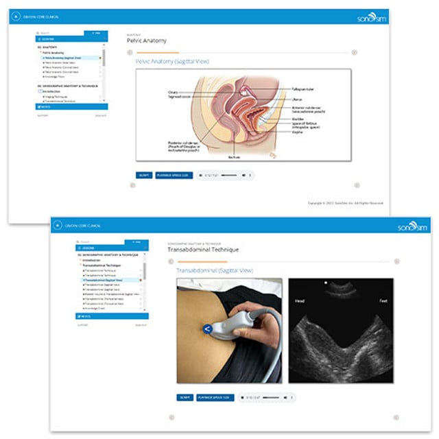 OBGYN Clinical Ultrasound Training | SonoSim