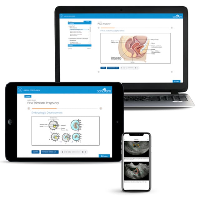 OBGYN Clinical Ultrasound Training | SonoSim