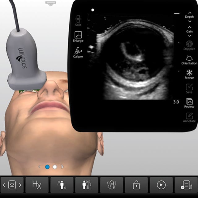 Ocular Clinical Ultrasound Training | SonoSim