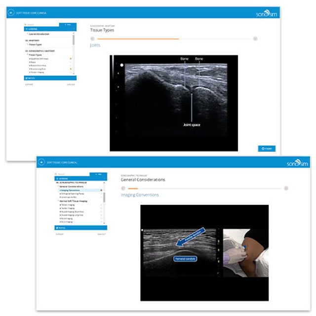 Soft Tissue Clinical Ultrasound Training | SonoSim