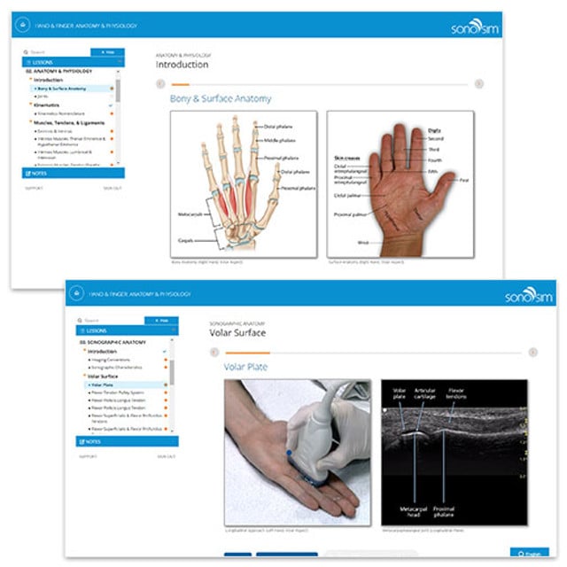 Hand & Finger Anatomy & Physiology Ultrasound Training | SonoSim