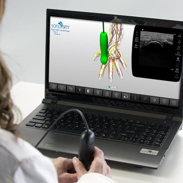Hand & Finger Anatomy & Physiology Ultrasound Training | SonoSim
