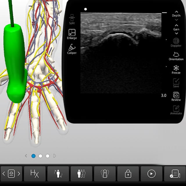Hand & Finger Anatomy & Physiology Ultrasound Training | SonoSim