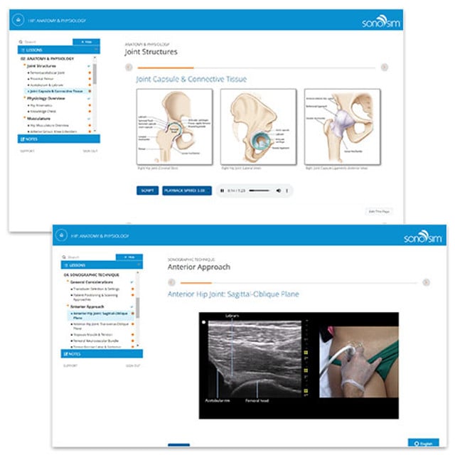 Hip Anatomy & Physiology Ultrasound Training | SonoSim