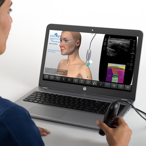 Acromioclavicular Joint Injection & Aspiration Ultrasound-Guided ...
