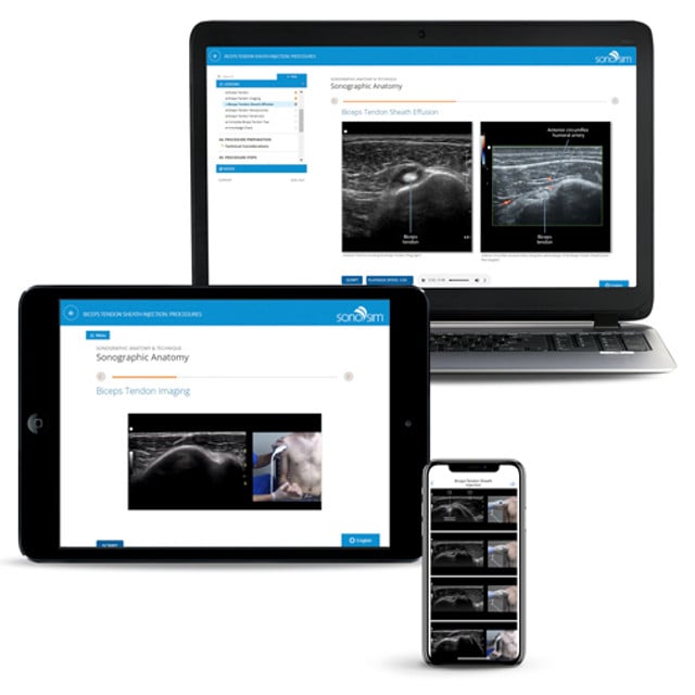 Biceps Tendon Sheath Injection Ultrasound-Guided Procedure Training ...