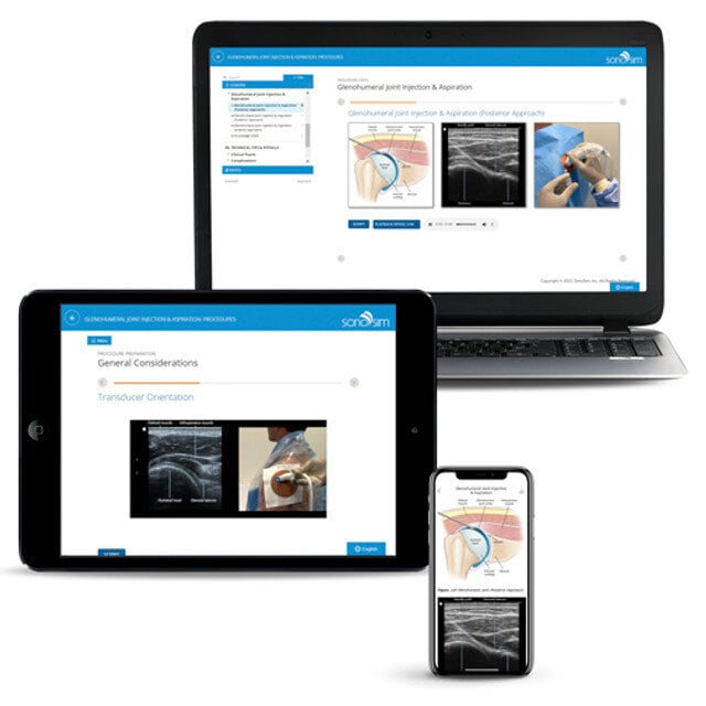 Glenohummeral Joint Injection & Aspiration Procedure | SonoSim