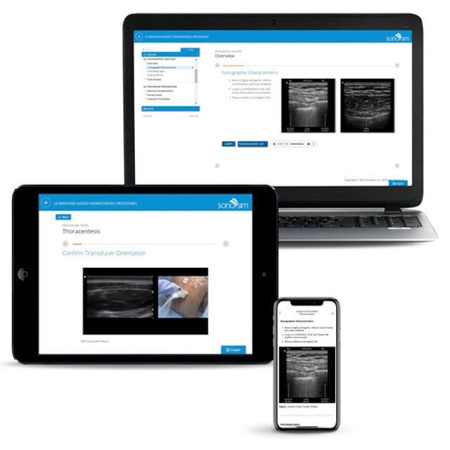 Ultrasound-Guided Thoracentesis Procedure Training | SonoSim