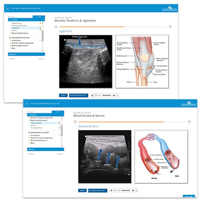 Soft Tissue Anatomy & Physiology Ultrasound Training | SonoSim