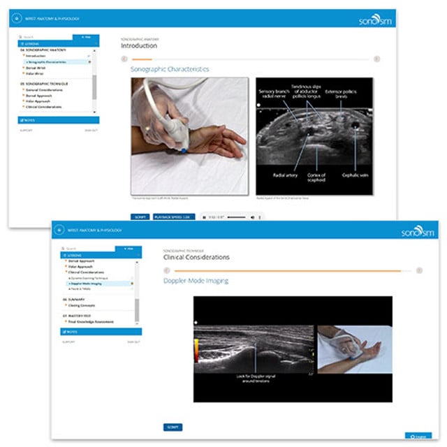 Wrist Anatomy & Physiology Ultrasound Training | SonoSim
